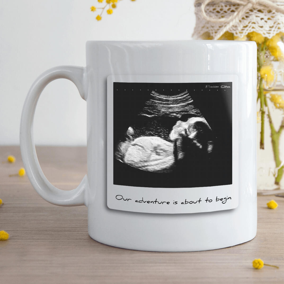 Personalised Baby Scan Photo Upload Durham Mug | Boutique Gifts
